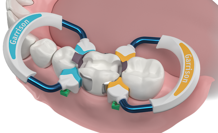 Strata-G™ Sectional Matrix System Kits